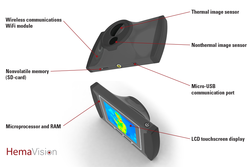 HemaVision uses both a thermal sensor array and a visible light sensor ...
