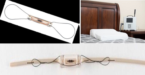 CardioMEMS HF System measures and monitors real-time 24×7 pulmonary ...