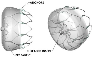 FDA Approved ‘WATCHMAN’ that prevents LAA blood clots from entering the ...