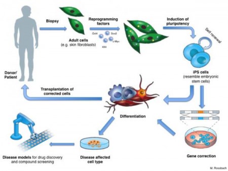 UCI Stem-Cell Pioneer Poised to Launch Clinical Trial for Retinitis ...