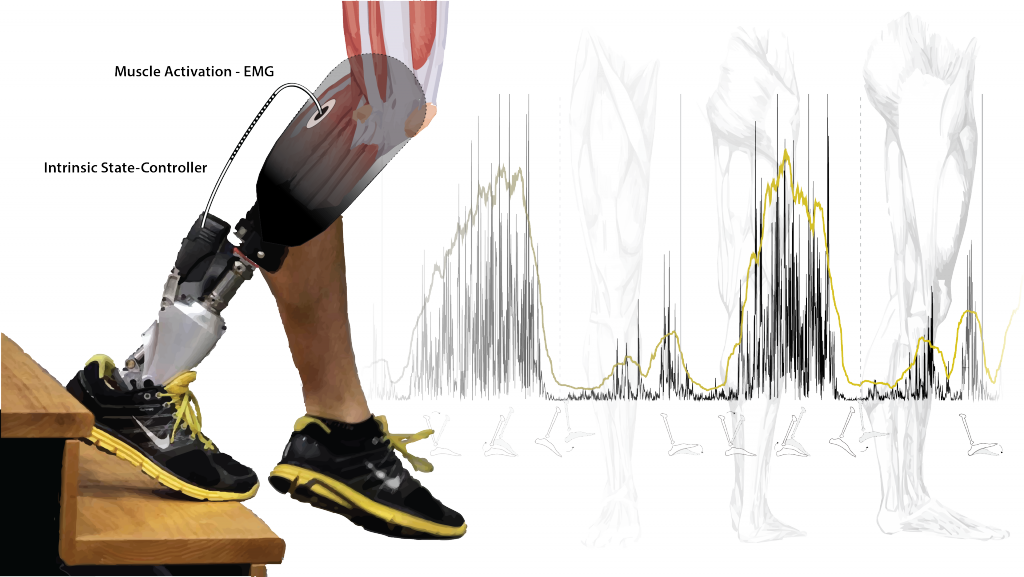 MIT research on neural control of bionic prostheses will allow users to ...