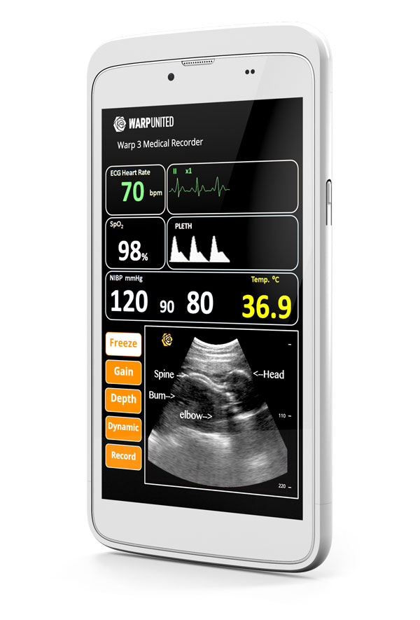 Warp 3 Medical Recorder for Ultrasound and Vital Signs Monitoring ...