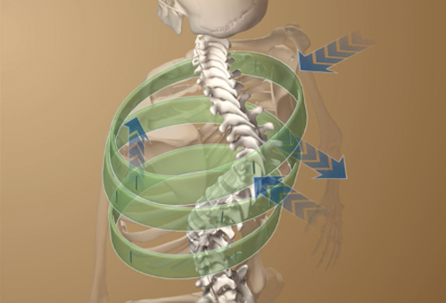 Dynamic Spinal Alignment Brace For People With Scoliosis | Innovation ...