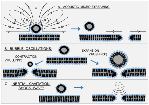 ‘Sonoporation’ Gene transfer using ultrasound | Innovation Essence