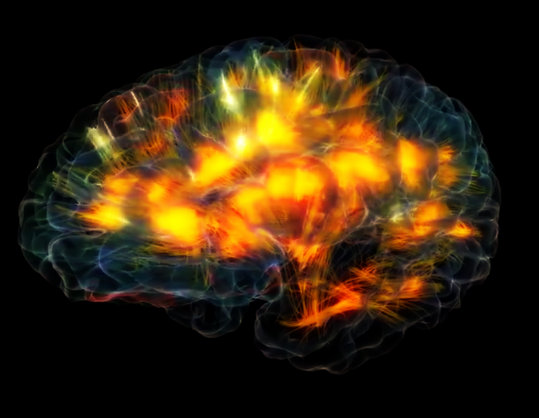 University of California has developed 'Glass Brain' that provides real ...