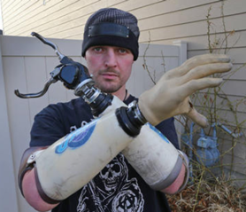University of Utah Department of Bioengineering is developing device ...