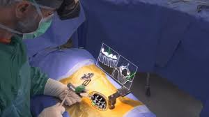 AugMedics – augmented reality guidance system for surgery | Innovation ...