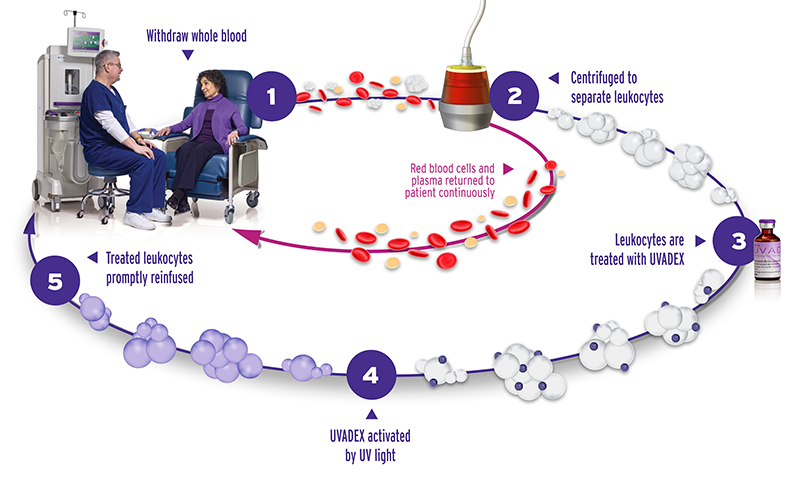 'Photopheresis' medical treatment | Innovation Essence