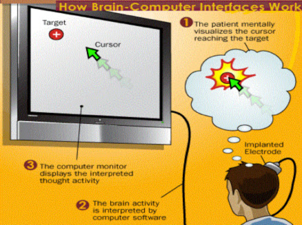 BCI technology - Brain–Computer Interface | Innovation Essence